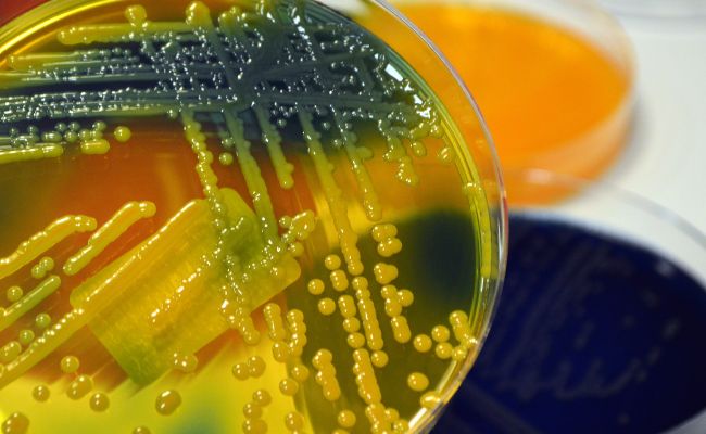 What Is Biofilm and Why Ship Owners Must Prevent Its Growth